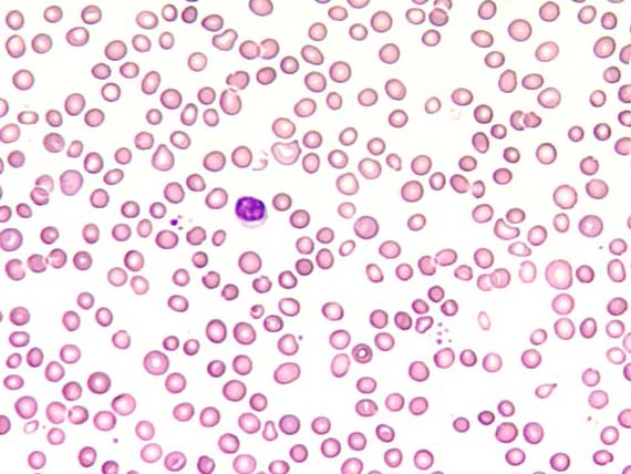 HemoSurf - programme de démonstration!