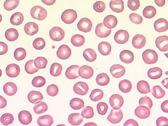 HemoSurf - programme de démonstration!