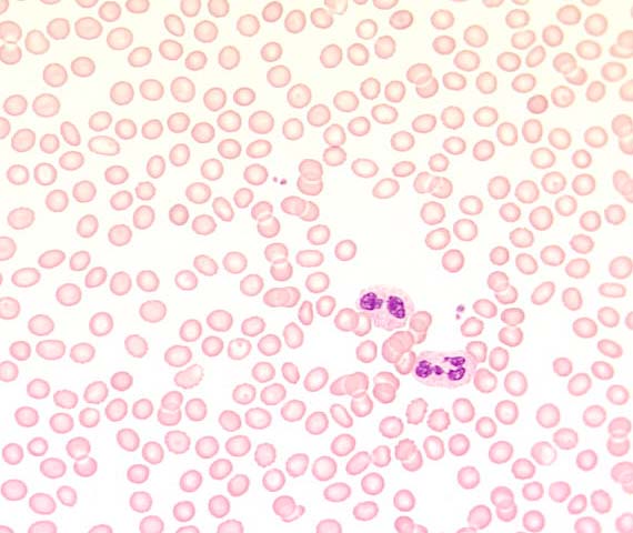 HemoSurf - programme de démonstration!