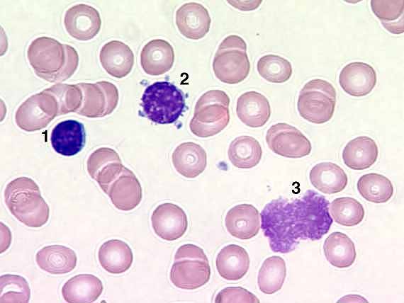 HemoSurf - programme de démonstration!