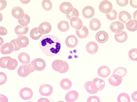 HemoSurf - programme de démonstration!