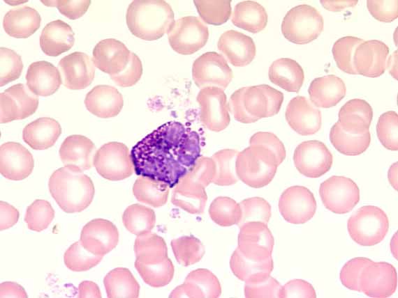 HemoSurf - programme de démonstration!